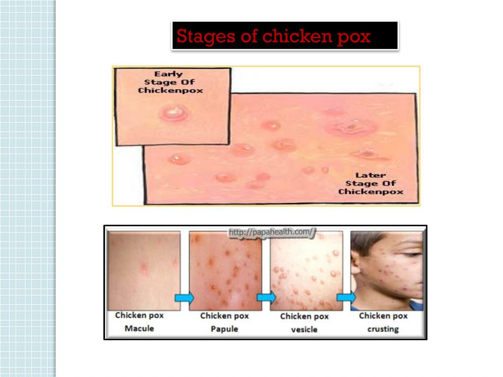 PPT - ORAL MUCOSA DISEASES PowerPoint Presentation, free download - ID ...