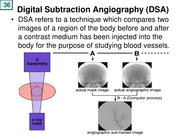 PPT - Digital APPLICATIONS C- Arm & DSA & Radiation Dose PowerPoint ... PPT - Digital APPLICATIONS C- Arm & DSA & Radiation Dose PowerPoint ...