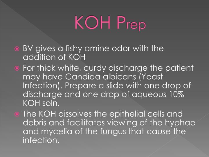 PPT - Pelvic Examination PowerPoint Presentation - ID:6612684