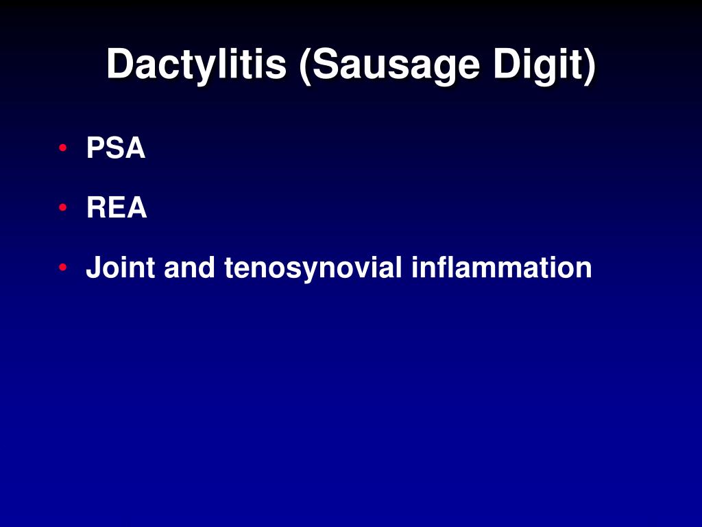 PPT - Low Back Pain and the Seronegative Spondyloarthropathies ...