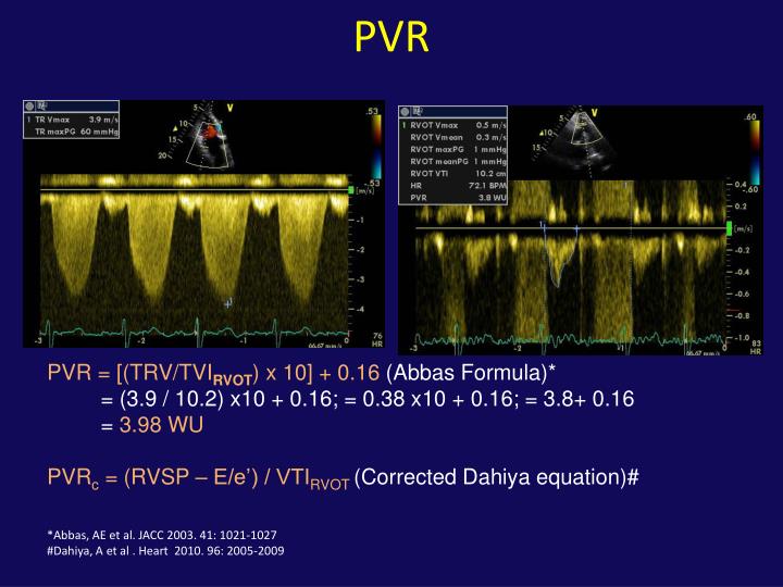 PPT - Role of the Echocardiogram in the Assessment of Pulmonary ...
