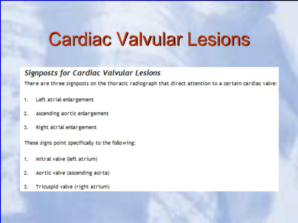 PPT - Chest X-ray signs of cardiac disease PowerPoint Presentation ...