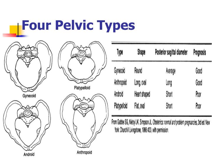 PPT - Operative Vaginal Delivery PowerPoint Presentation - ID:6621084