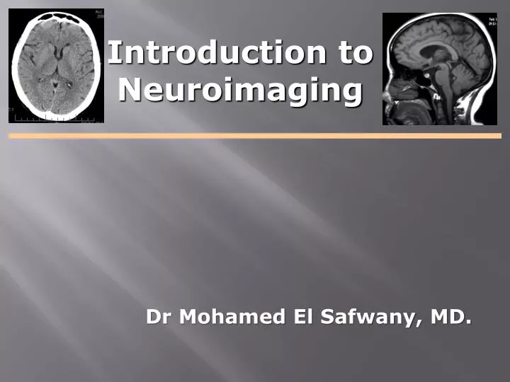 PPT - Introduction to Neuroimaging PowerPoint Presentation, free download - ID:6622454