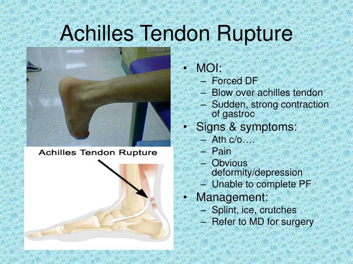 PPT - FOOT, ANKLE AND LOWER LEG PowerPoint Presentation - ID:6623430
