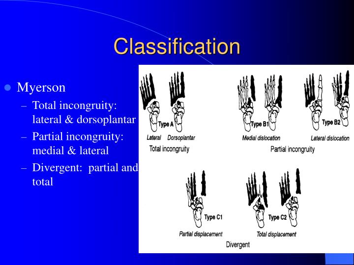 PPT - LISFRANC INJURIES PowerPoint Presentation - ID:6623438