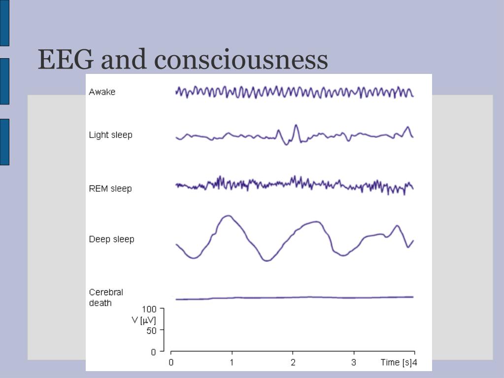 PPT - Introduction to EEG, EMG-NCV PowerPoint Presentation, free ... PPT - Introduction to EEG, EMG-NCV PowerPoint Presentation, free ...