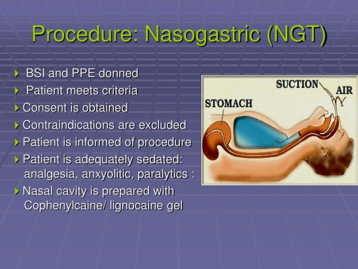 PPT - Gastric Tube Placement PowerPoint Presentation - ID:6624984
