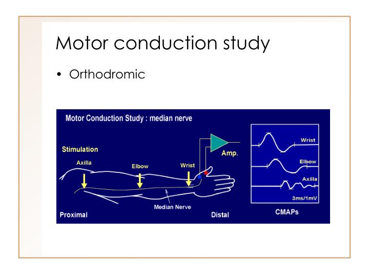 PPT - Nerve conduction PowerPoint Presentation - ID:6625003