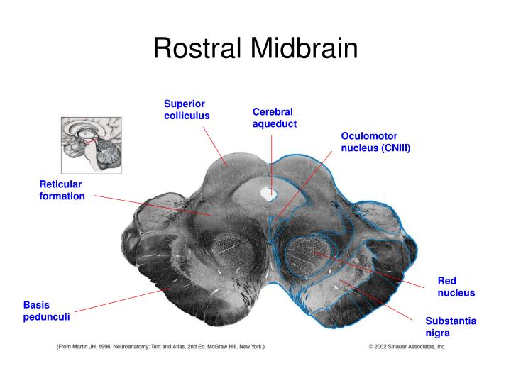 PPT - Chapter 14 Brainstem III: Internal Structures and Vascular Supply ...
