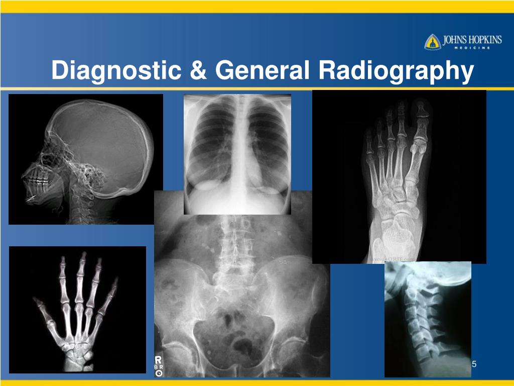 PPT - The Radiography Student at The Johns Hopkins Hospital PowerPoint ...