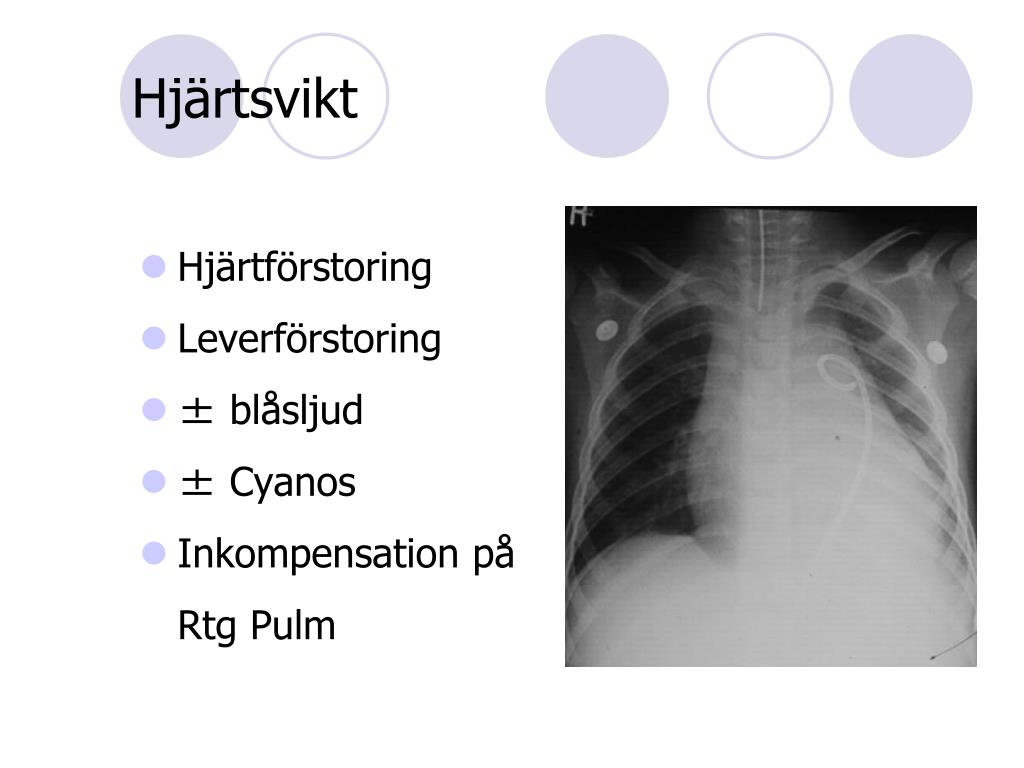 PPT - Skillnader i andningsfysiologi mellan barn och vuxna PowerPoint ...