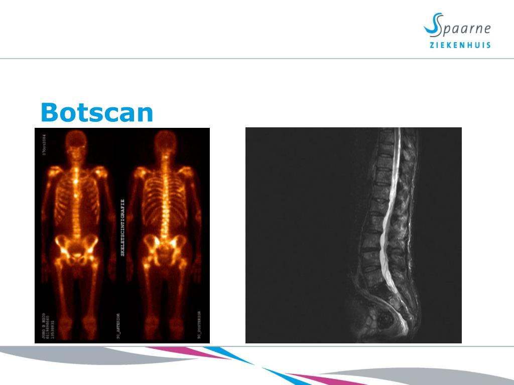 PPT - onderzoeken Arjen Noordzij PowerPoint Presentation, free download ...