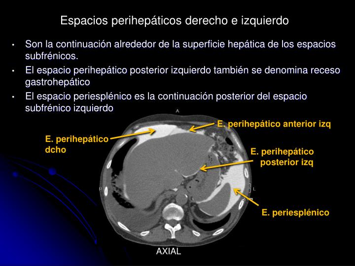 PPT - ANATOMÍA DEL PERITONEO PowerPoint Presentation - ID:6634252