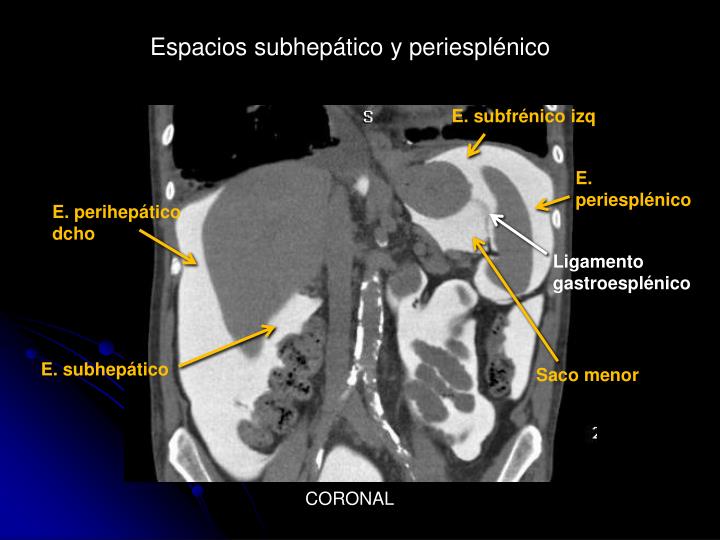 PPT - ANATOMÍA DEL PERITONEO PowerPoint Presentation - ID:6634252
