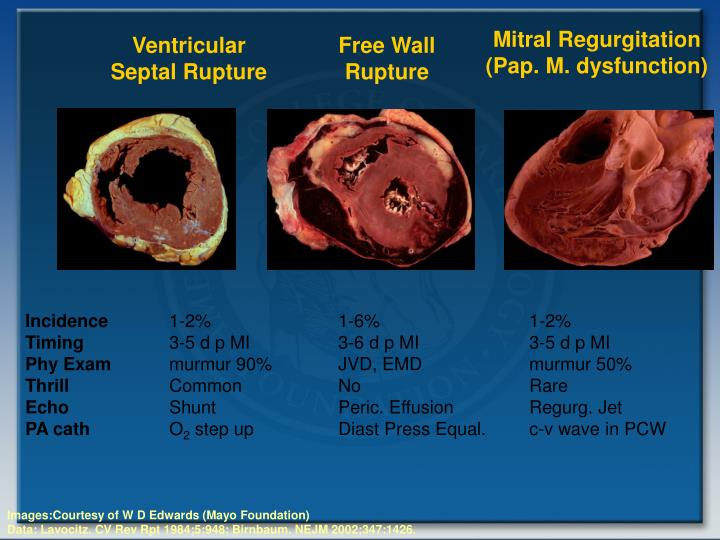 PPT - UNIVERSIDAD RICARDO PALMA FACULTAD DE MEDICINA HUMANA PowerPoint ...