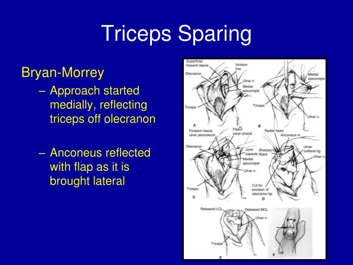 PPT - Distal Humerus Fractures PowerPoint Presentation - ID:6635025
