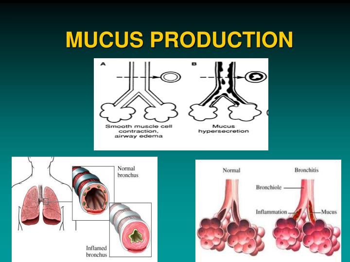 PPT - Chronic Obstructive Pulmonary Disease PowerPoint Presentation ...