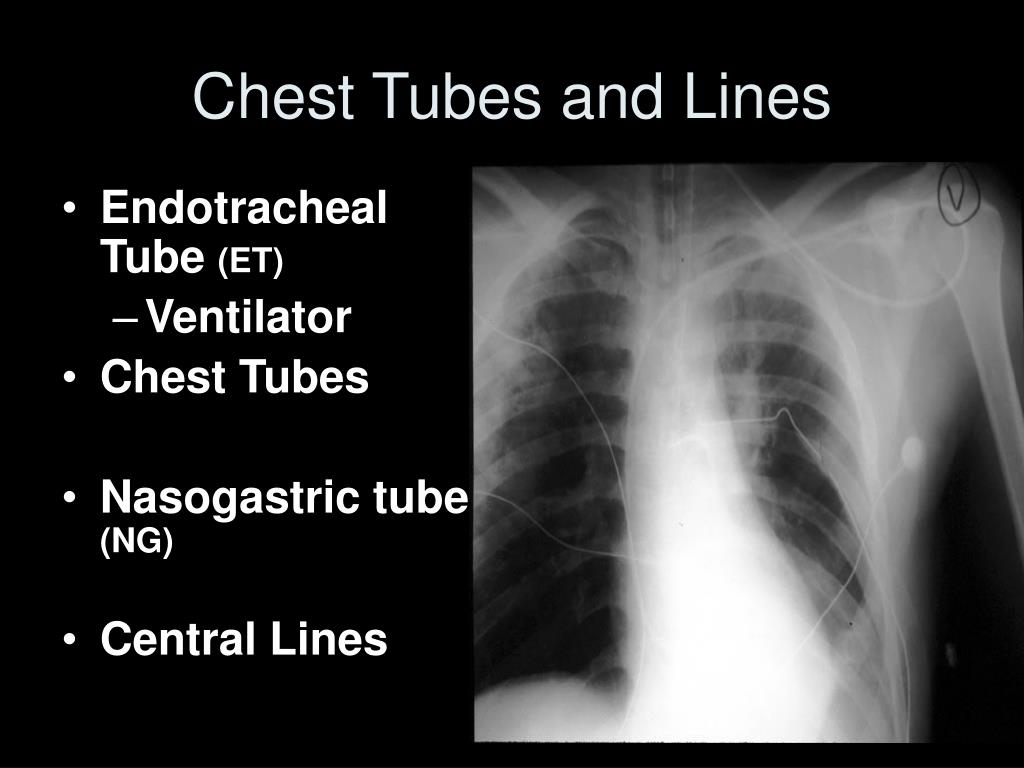 PPT - Vital Signs, Oxygen & Medical Emergencies PowerPoint Presentation ...