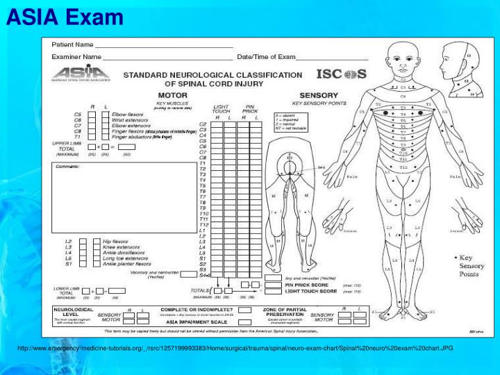 PPT - Spinal Cord Injury PowerPoint Presentation - ID:6638740