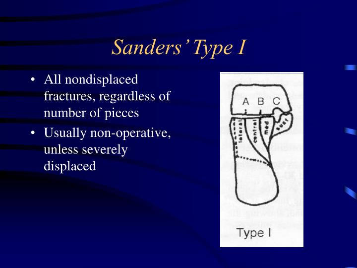 PPT - Calcaneus Fractures PowerPoint Presentation - ID:6638785