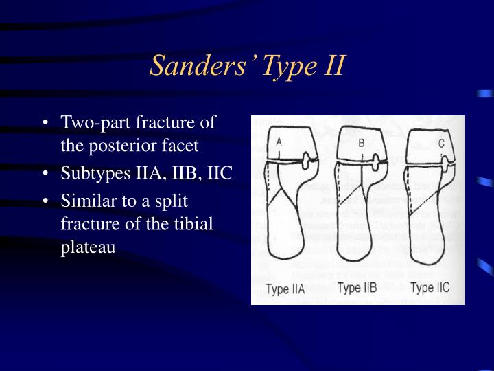 PPT - Calcaneus Fractures PowerPoint Presentation - ID:6638785