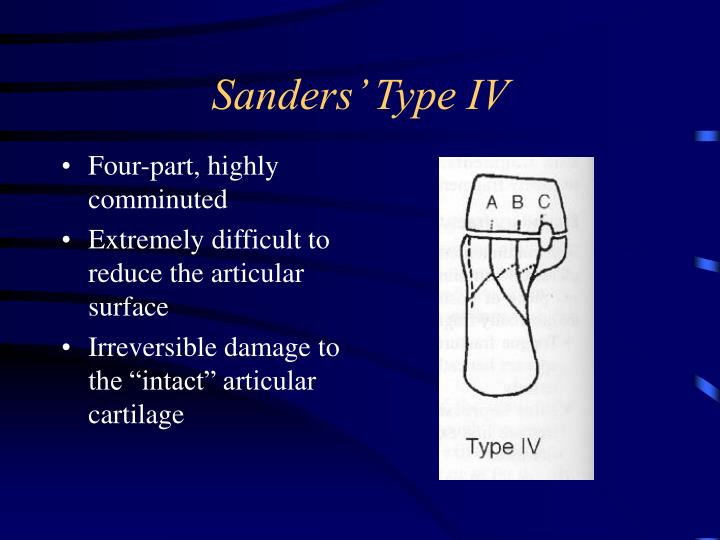 PPT - Calcaneus Fractures PowerPoint Presentation - ID:6638785