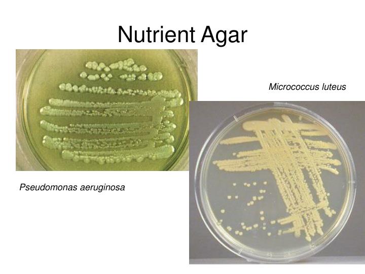 PPT - EMB agar PowerPoint Presentation - ID:6641071