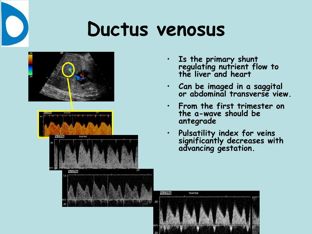 PPT - Antenatal Surveillance PowerPoint Presentation, free download ...