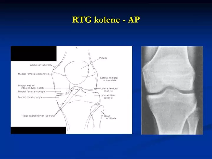 PPT - RTG kolene - AP PowerPoint Presentation, free download - ID:6643805