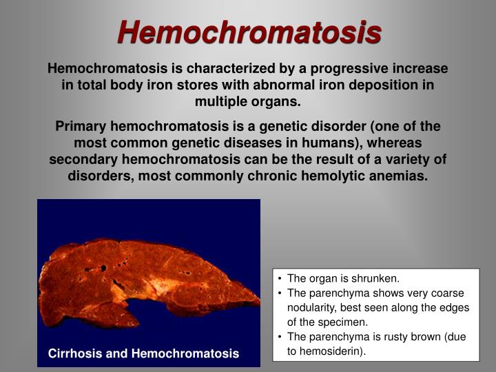 PPT - Diffuse Liver Disease PowerPoint Presentation - ID:6644888