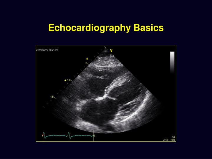 PPT - Basic Echocardiography PowerPoint Presentation - ID:6645946