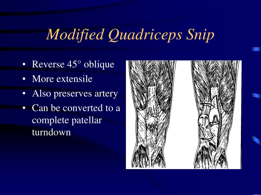 PPT - Surgical Approaches In Total Knee Arthroplasty PowerPoint ...