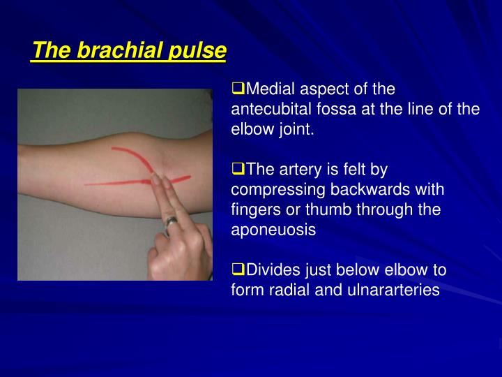 PPT - Arterial Pulse PowerPoint Presentation - ID:6649108