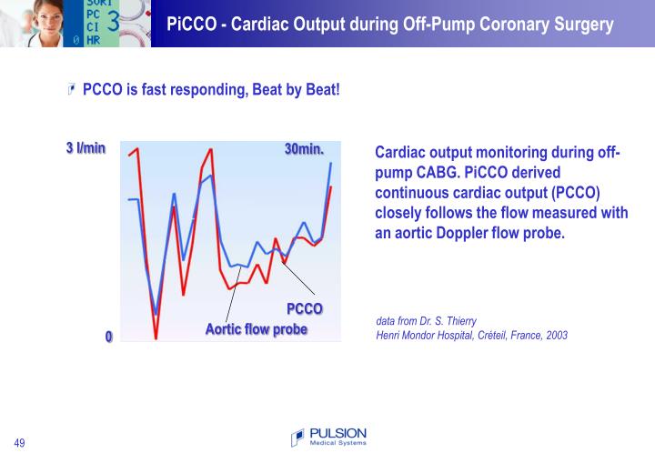 PPT - PiCCO plus PowerPoint Presentation - ID:6649350