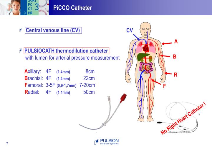 PPT - PiCCO plus PowerPoint Presentation - ID:6649350