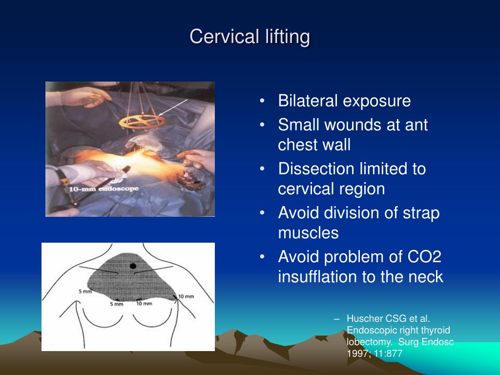 PPT - Joint Hospital Grand Round PowerPoint Presentation, free download ...