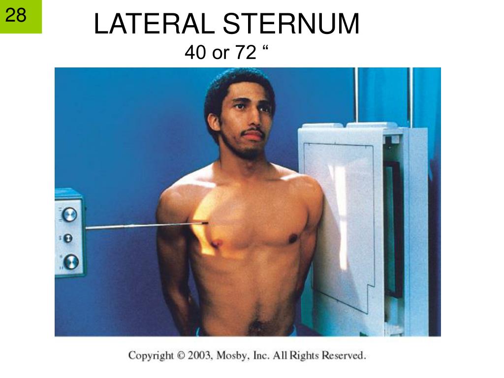 PPT - Shoulder Ch. 6 & Bony Thorax Ch. 9 Part 3 SCAPULA STERNUM (RIBS ...