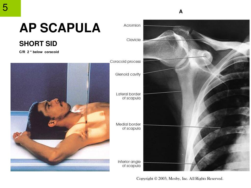 PPT - Shoulder Ch. 6 & Bony Thorax Ch. 9 Part 3 SCAPULA STERNUM (RIBS ...