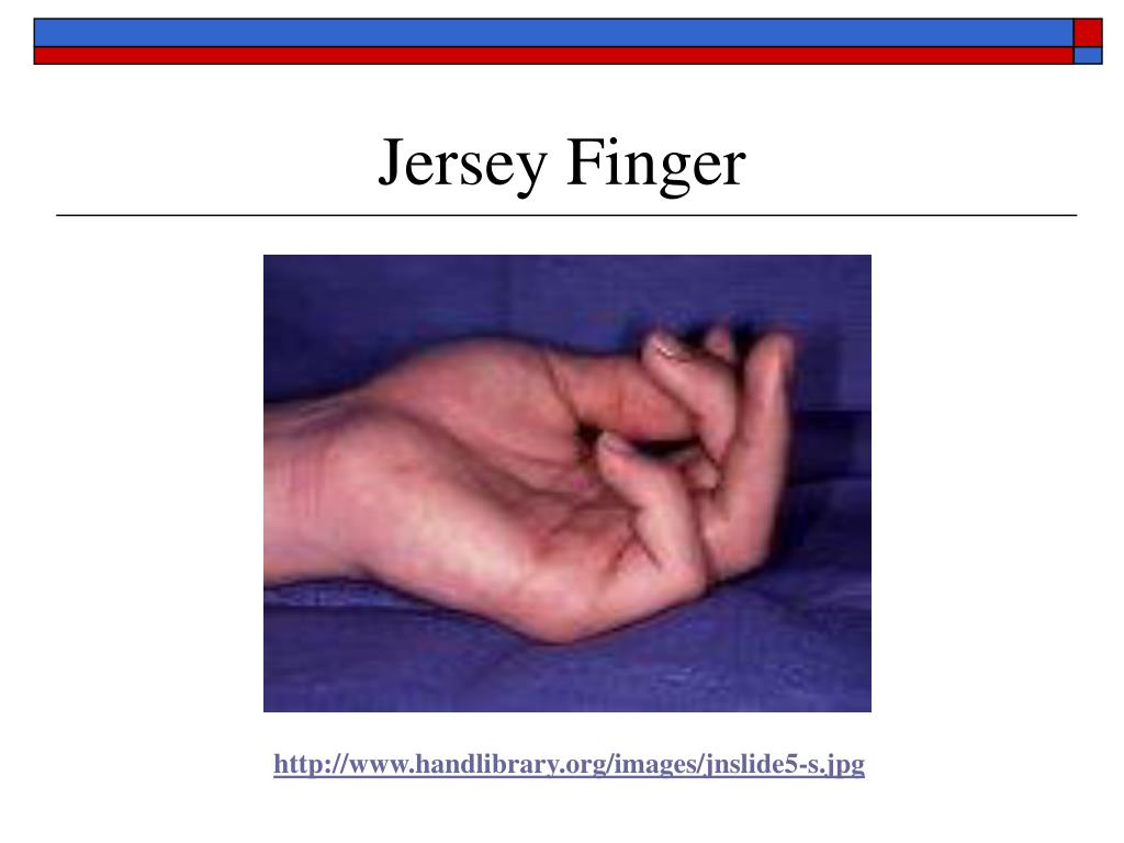 PPT - Wrist/Hand Anatomy PowerPoint Presentation, free download - ID ...