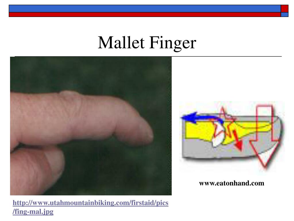PPT - Wrist/Hand Anatomy PowerPoint Presentation, free download - ID ...
