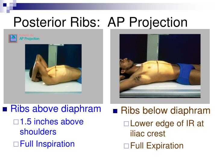 PPT - Bony Thorax PowerPoint Presentation - ID:6654164