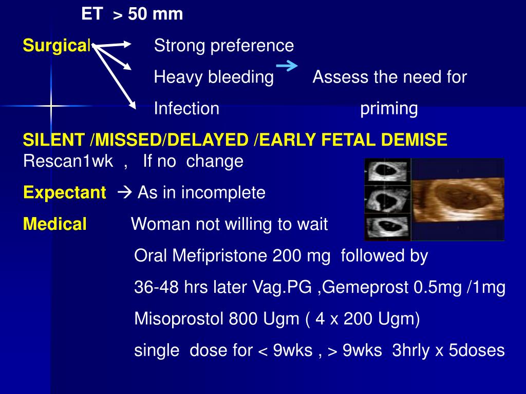 Ppt First Trimester Induction Protocols And Complications Powerpoint