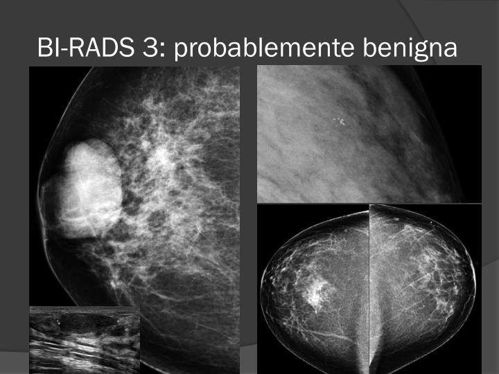 PPT - Ginecología y obstetricia PowerPoint Presentation - ID:6656919