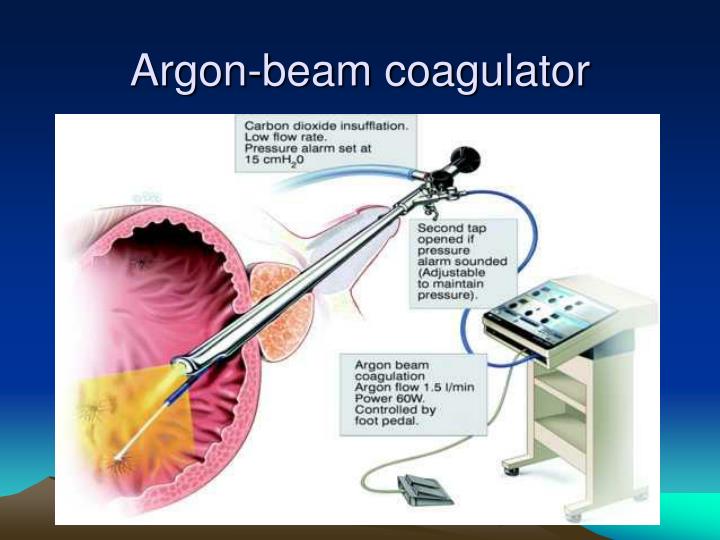 PPT - Radiation Cystitis - Role of Minimally invasive Procedures ...