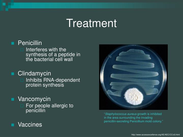 PPT - Streptococcus pyogenes PowerPoint Presentation - ID:6658249