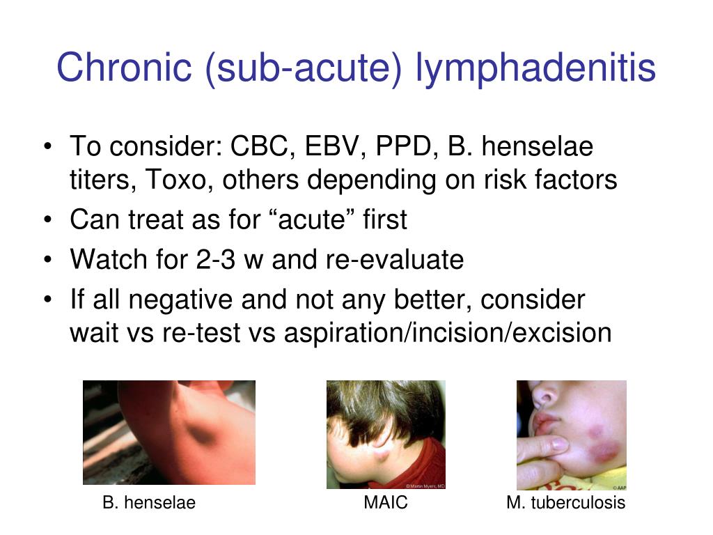 PPT - Common Outpatient Infections PowerPoint Presentation, free ...