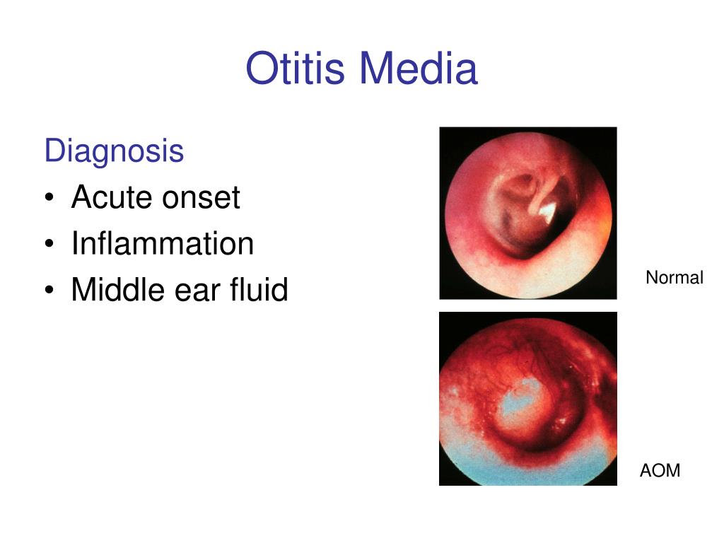 PPT - Common Outpatient Infections PowerPoint Presentation, free ...