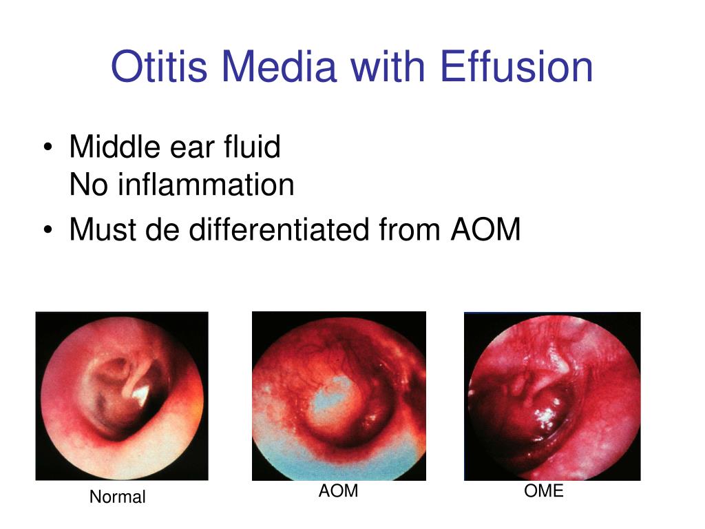 PPT - Common Outpatient Infections PowerPoint Presentation, free ...