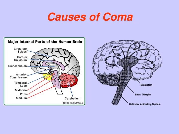 PPT - Decreased level of consciousness PowerPoint Presentation - ID:6660923